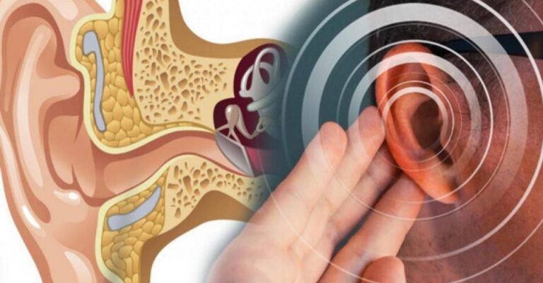 What is Meniere's Disease? - Turkey Istanbul Medical