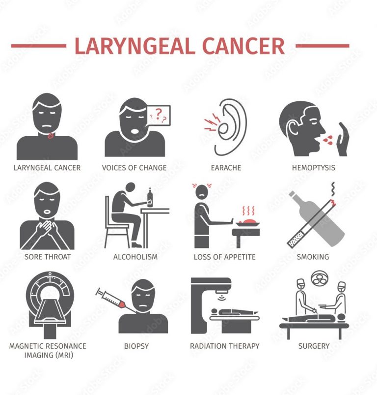 What is Laryngeal Cancer? - Turkey Istanbul Medical